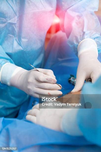 수술실에서 수술을 제공하면서 특수 도구를 사용하는 외과 의사 남성 외과 의사의 초상화 의학 및 수술 개념 간호사에 대한 스톡 사진 및 기타 이미지 Istock