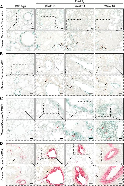 Identification Of Cell Types Undergoing Apoptosis In The Fos Related