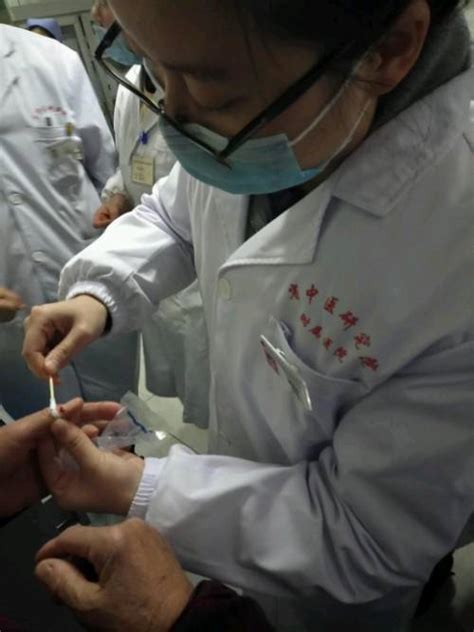 针刺放血治疗咽喉图 喉咙痛手指扎针放图 针刺放 大山谷图库