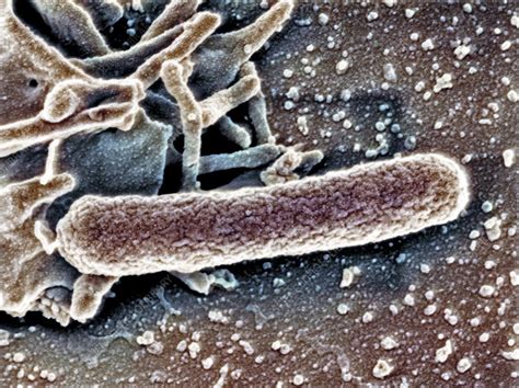 Pseudomonas Bacterium Sem Stock Image C014 8268 Science Photo