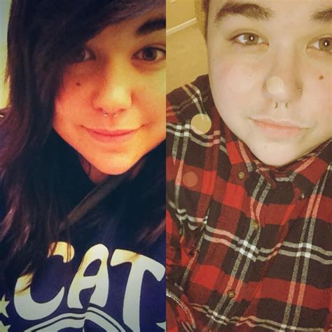 non binary but afab pre everything i know i want top surgery but idk