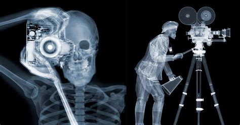 How To Take X Ray Pictures With Camera At Julie Sherwood Blog