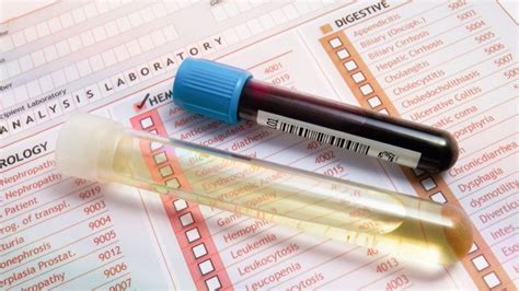 The Definitive Guide To Interpreting Functional Lab Tests Beyond Normal To Optimal Health