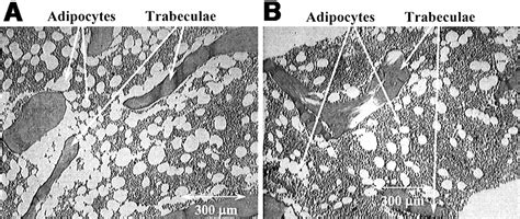 Adipocyte Spatial Distributions In Bone Marrow Implications For