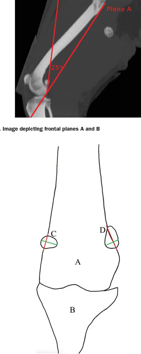 Figure 2 From Are The Fabellae Bisected By The Femoral Cortices In A True Craniocaudal Pelvic