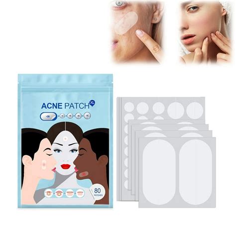 Acne Pimple Patches 5 Sizes Acne Patches Waterproof Hydrocolloid Acne