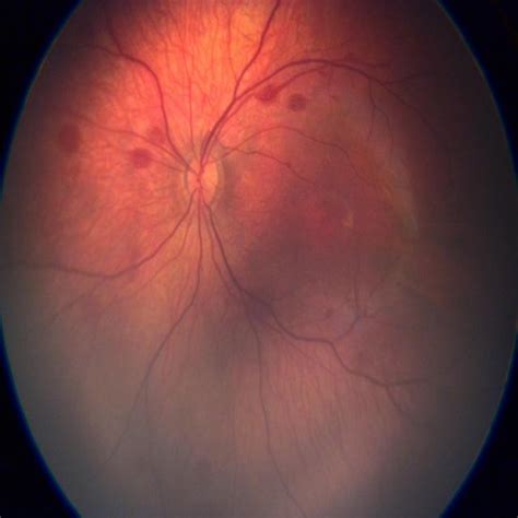 Object Detection Part 01 Object Detection Dataset By Iot Mini Project