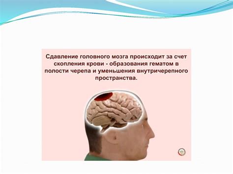 Черепно-мозговая травма - презентация онлайн