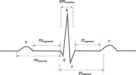 systematic representation of ecg waveform download scientific diagram