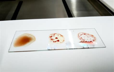 Test De Groupe Sanguin Par Méthode Dagglutination Sur Lame Au Laboratoire Médical Photo Premium