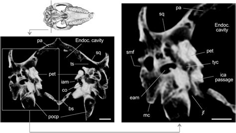 Axial Ct Slice Of R Equinus Mpef Pv 695 At Level Of The Jugular Download Scientific Diagram