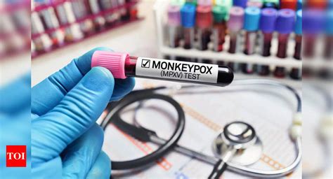 Monkeypox: African woman Delhi's 6th monkeypox case | Delhi News ...