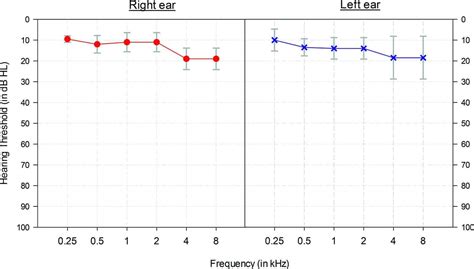 Evaluation Of A Hearing Aid Algorithm To Reduce The Negative Effects Of Reverberation