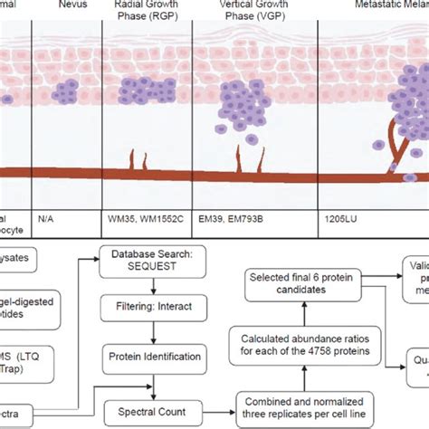 Examples Of Melanoma Tissues Expressing Different Levels Of Vimentin