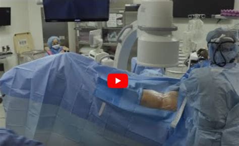 Hip Arthroscopy New York Core Decompression New York Avn New York
