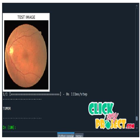 Best Final Year Project 2024 Data Mining Project 2024 Hybrid Retinal Image Enhancement