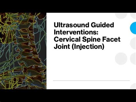 Ultrasound Guided Interventions Cervical Spine Facet Joint Injection