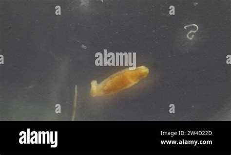 The Study Parasite Or Worms Is A Freshwater Fish Parasite In Laboratory
