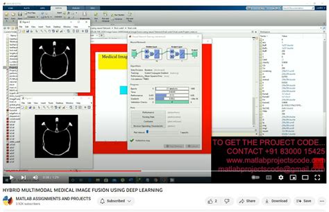 HYBRID MULTIMODAL MEDICAL IMAGE FUSION USING DEEP LEARNING