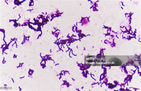 Gram Staining Also Called Grams Method Is A Method Of Differentiating