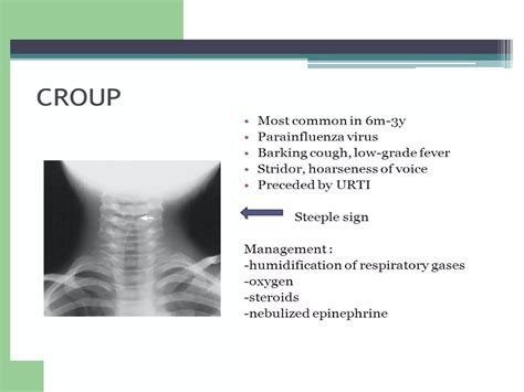 Croup Syndrome Ppt