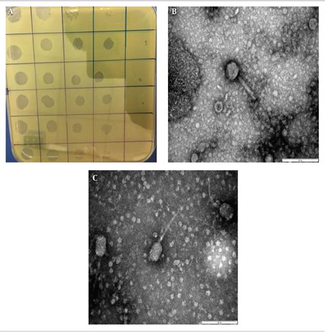 Figure 1 From Efficacy Of Phage Antibiotic Combinations Against