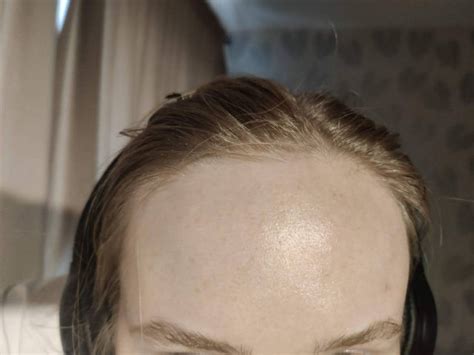 Differin Adapalene Cream 0 1 Best Korean Skincare Picky