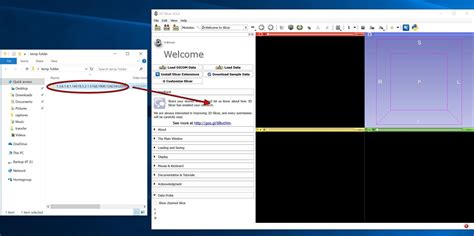 How To Easily And Automatically Convert A Ct Scan Dicom Data Into A