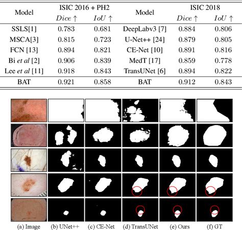 Boundary Aware Transformers For Skin Lesion Segmentation