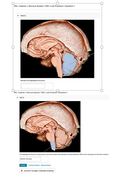 Solved Pal Cadaver Nervous System Cns Lab Practical