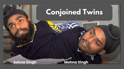 Indian Conjoined Twins Sohna Singh And Mohna Singh Inspirational Story Simply Life Tips