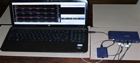 Stages For An Offline Myoelectric Pattern Recognition System Download Scientific Diagram