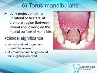 Intra Oral Mandibular Landmarks Pptx