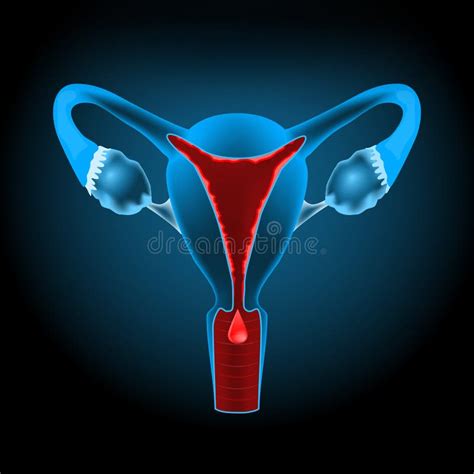 Uterine Bleeding Menstruation Stock Vector Illustration Of Vaginal Reproduction 312483269