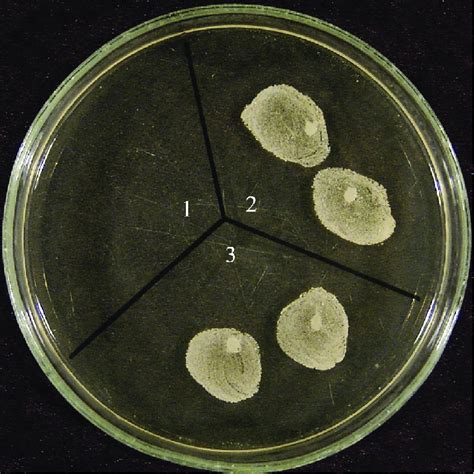 Staphylococcus Aureus Strains Sensitive To Oxacillin 1 And Resistant Download Scientific