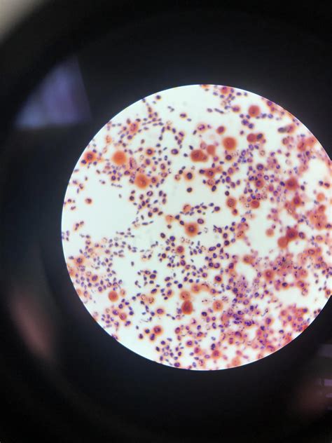 Gram Stain Of Csf Filled With Cryptococcus Neoformans Scrolller