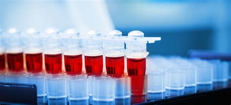 Biofluid Samples Geneticist Inc Worlds Premier Biorepository