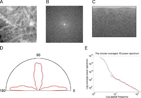 Detection Of Architectural Distortion In Prior Mammograms Via Analysis Of Oriented Patterns