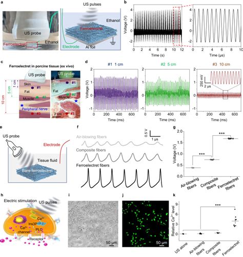 Soft Ferroelectret Ultrasound Receiver For Targeted Peripheral Neuromodulation Pmc