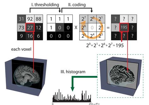 Figure 1 From Adhd Classification By A Texture Analysis Of Anatomical