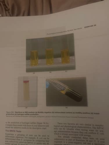 Lab Exam Flashcards Quizlet