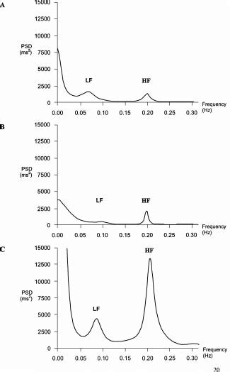 Spectral Analysis Showing Rr Interval Variability Download Scientific Diagram