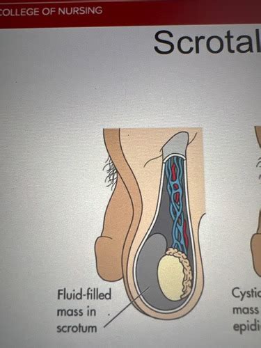 Male Reproductive System Patho 7450 Flashcards Quizlet