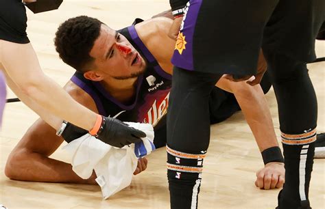 What happened to Devin Booker's nose? | The US Sun