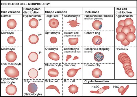 Pappenheimer Bodies Vs Basophilic Stippling