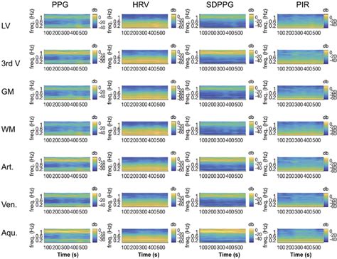 Cross‐spectrograms Linking Ppg‐derived Signals And Fmri Signals In