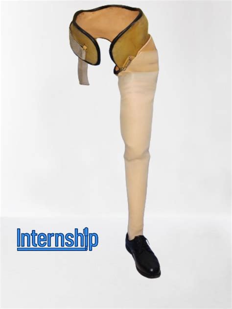 Amisha Bharti On Linkedin Hip Disarticulation Prostheses