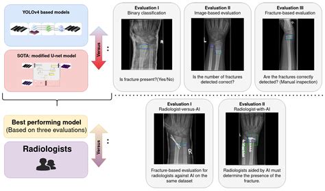 Fracture Recognition In Paediatric Wrist Radiographs An Object