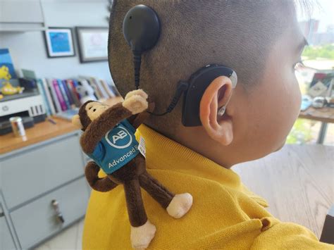 Implante Coclear — Corti Mx