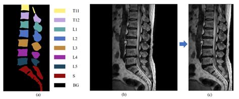 Schematic Diagram Of Spine Data Processing And Labeling A Is The